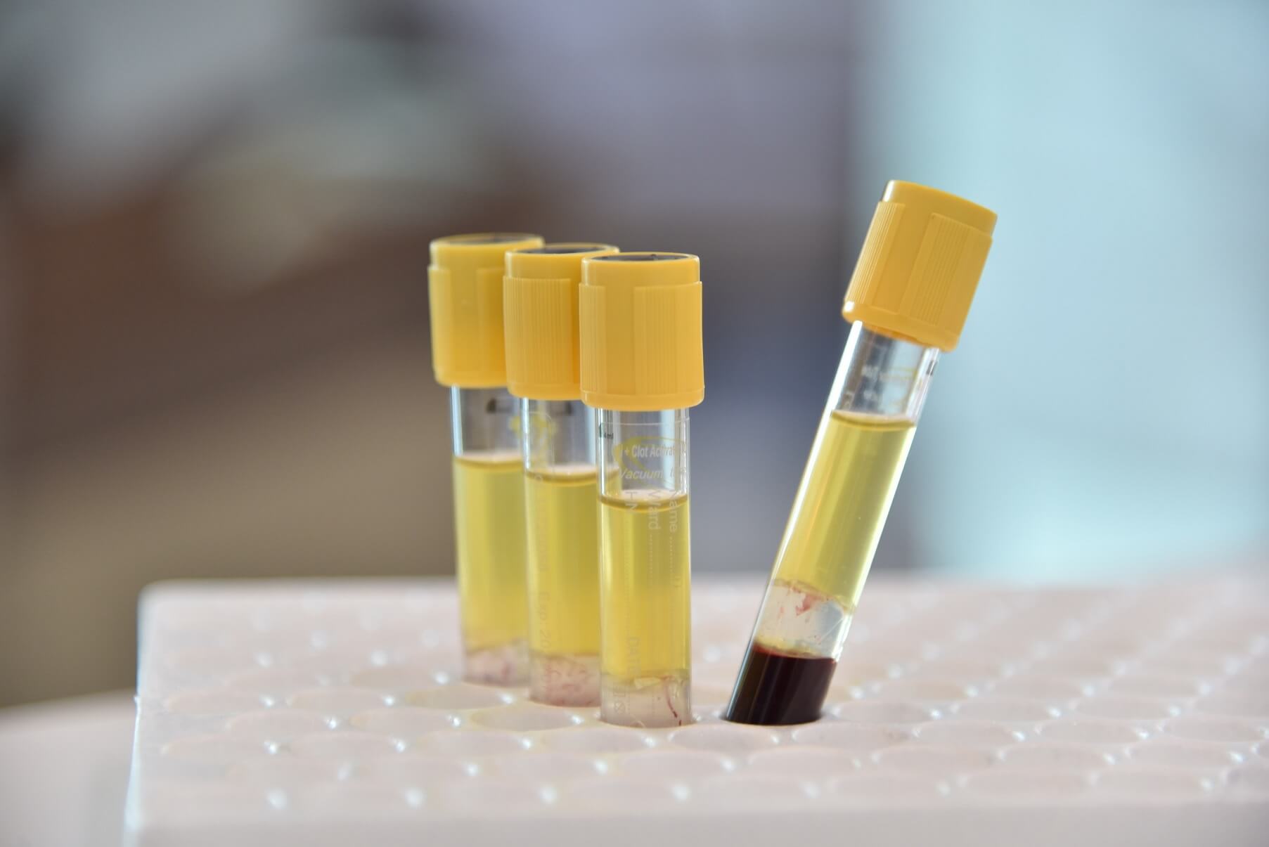 Discovering Platelet-Rich Plasma Therapy: Men's Health 2025