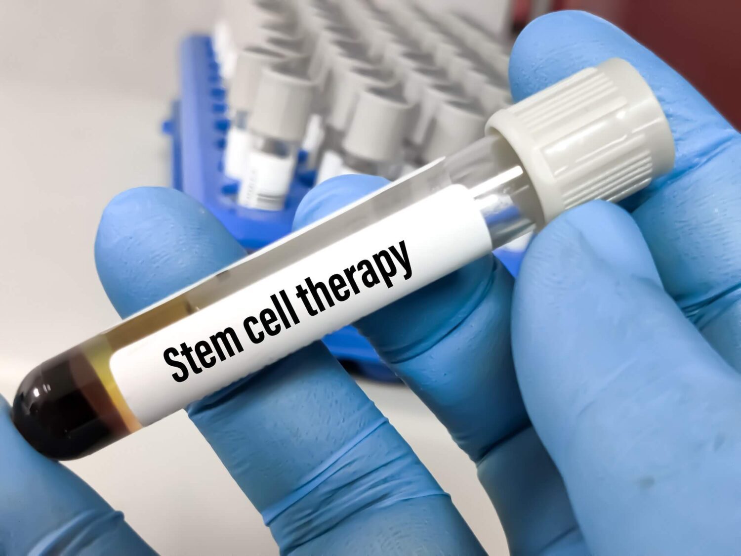 Cellular Rejuvenation and Healing: Stem Cell Therapies 2024
